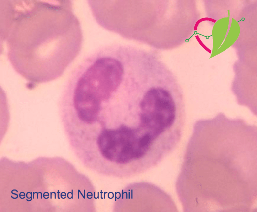 What are Band Neutrophils?