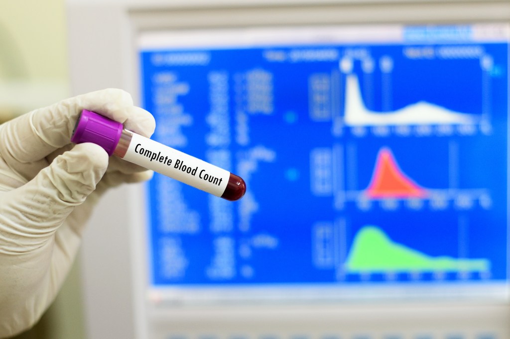 Your complete Guide to understand your Blood and Urine Lab results ...