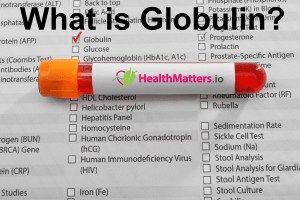 What is Globulin? Definition, Function and optimal Ranges