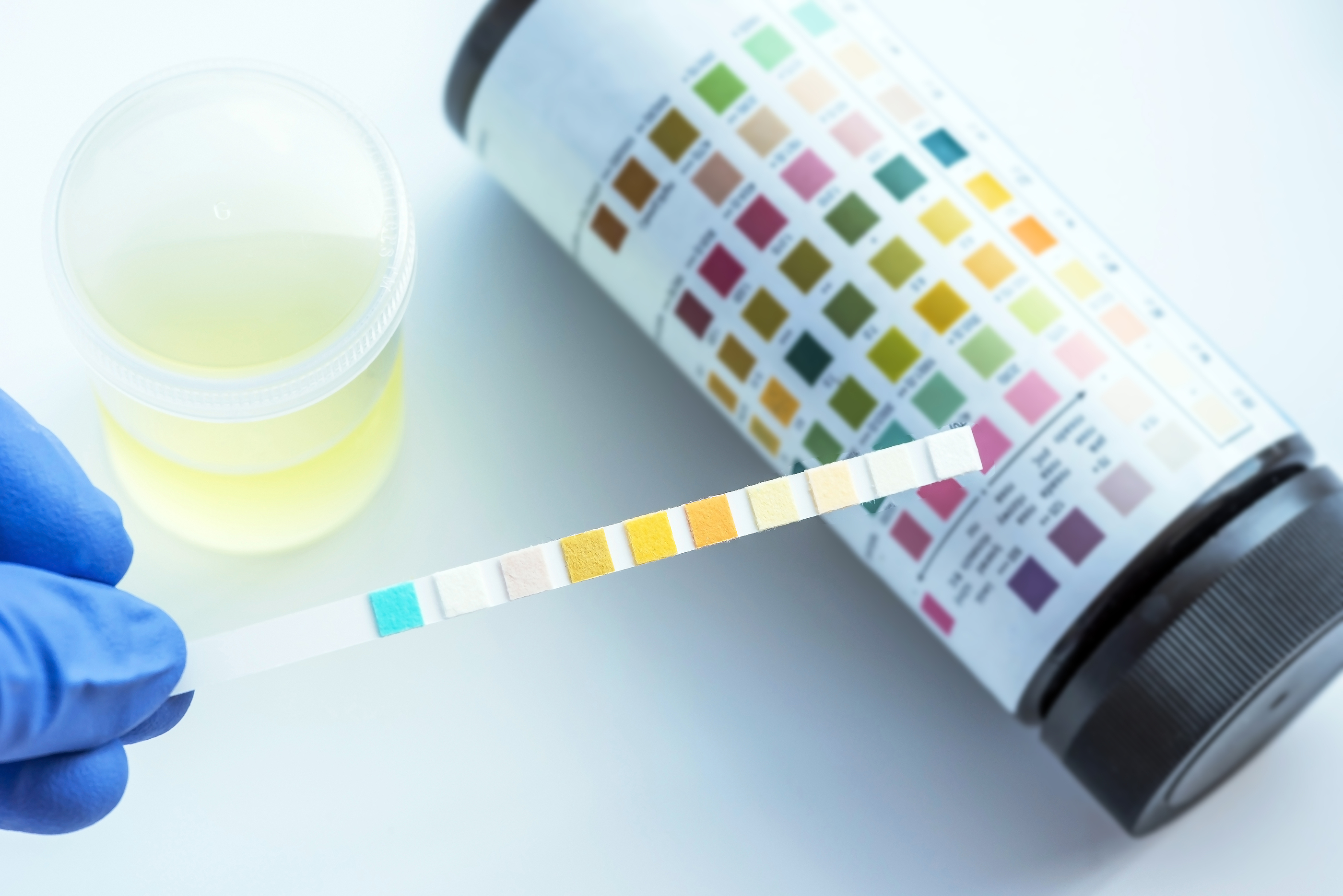 Your complete Guide to understand your Blood and Urine Lab results ...