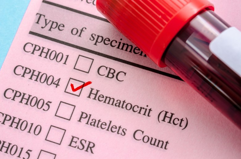 What does high hematocrit mean?