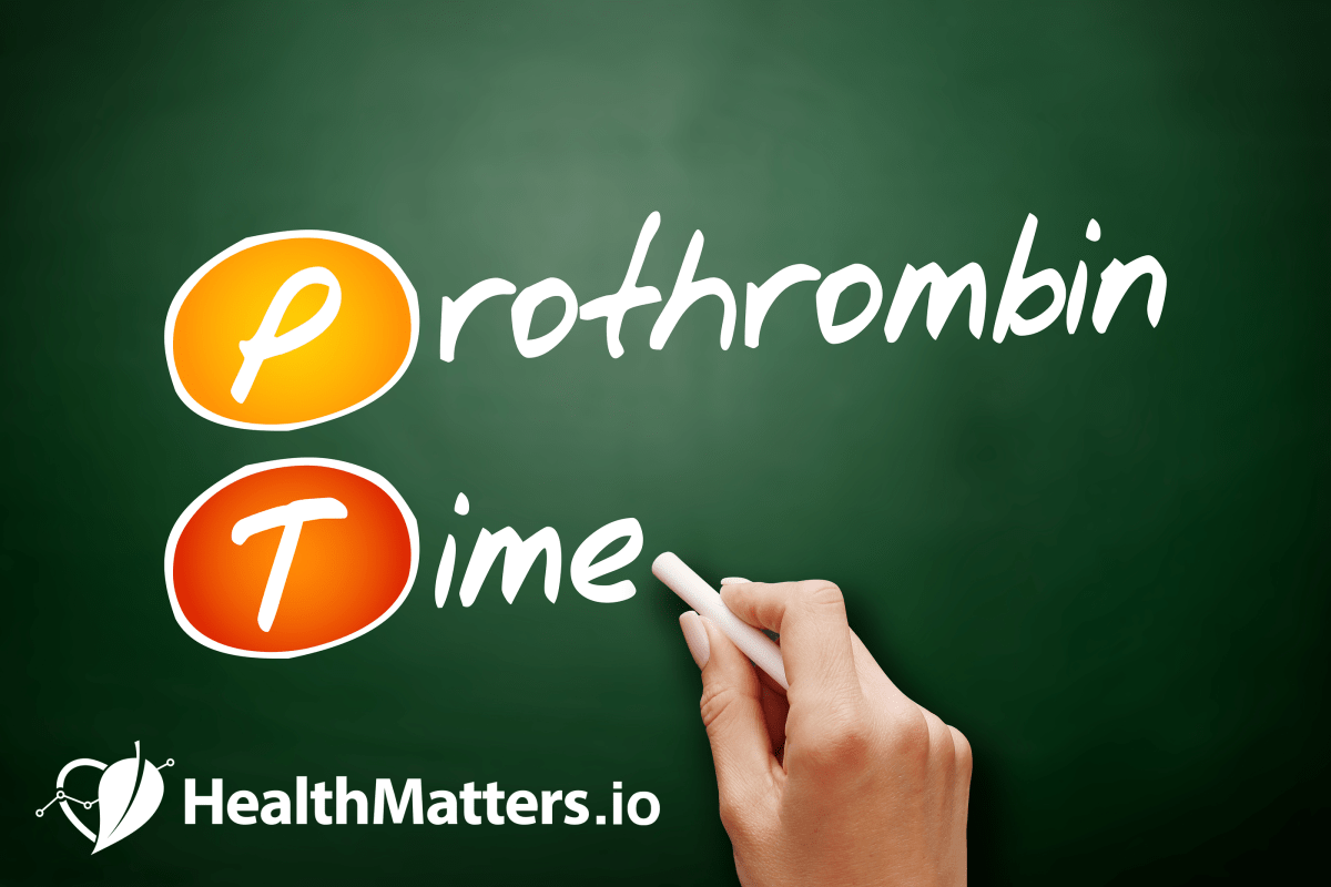 What is the Prothrombin Time (PT)?