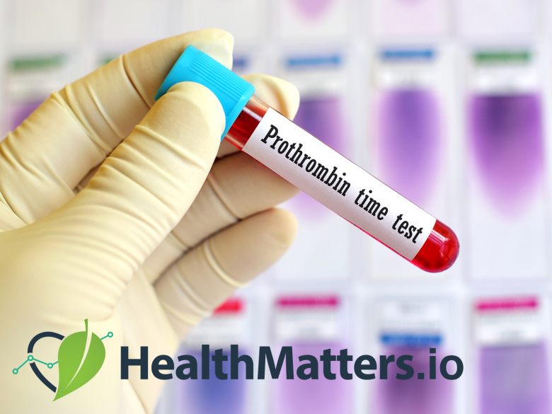 What is the Prothrombin Time (PT)?