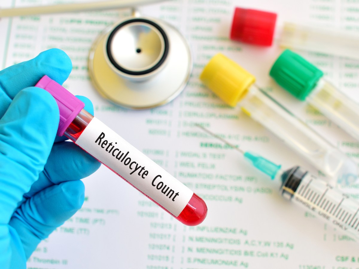 What are Reticulocytes?
