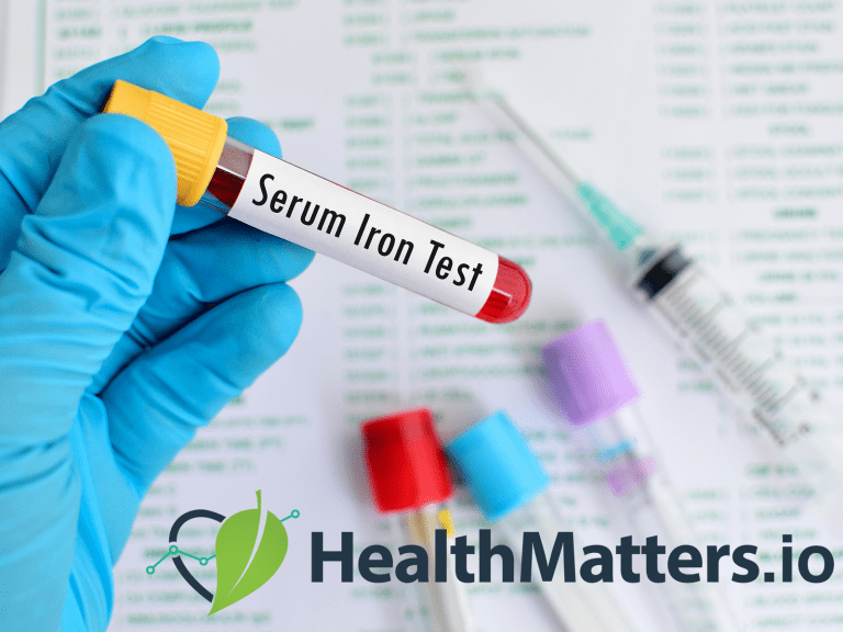 What is Serum Iron?