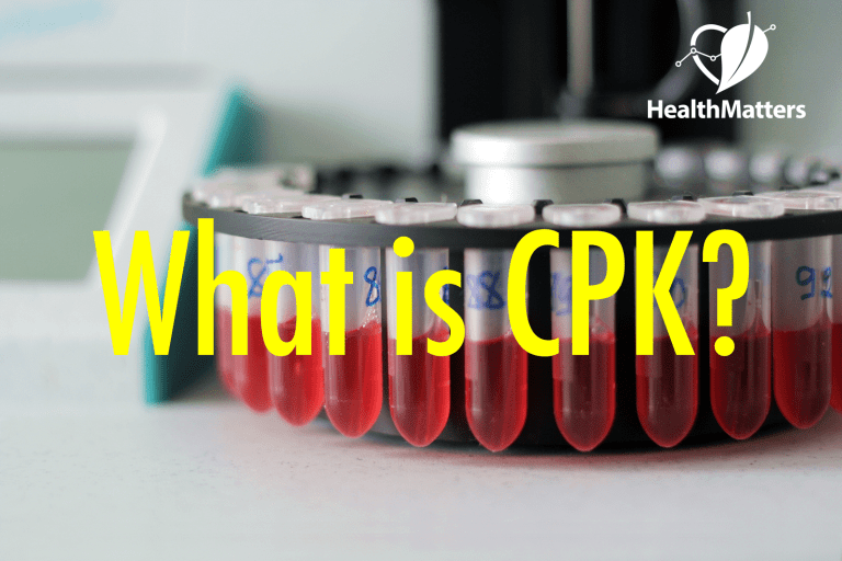 What is Creatine phosphokinase (CPK)?
