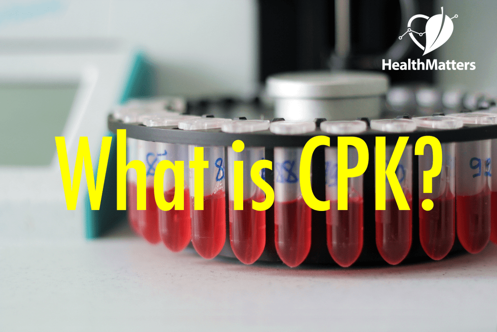 What is Creatine phosphokinase (CPK)?