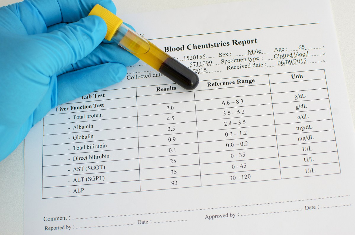 What is Beta Globulin, Serum?