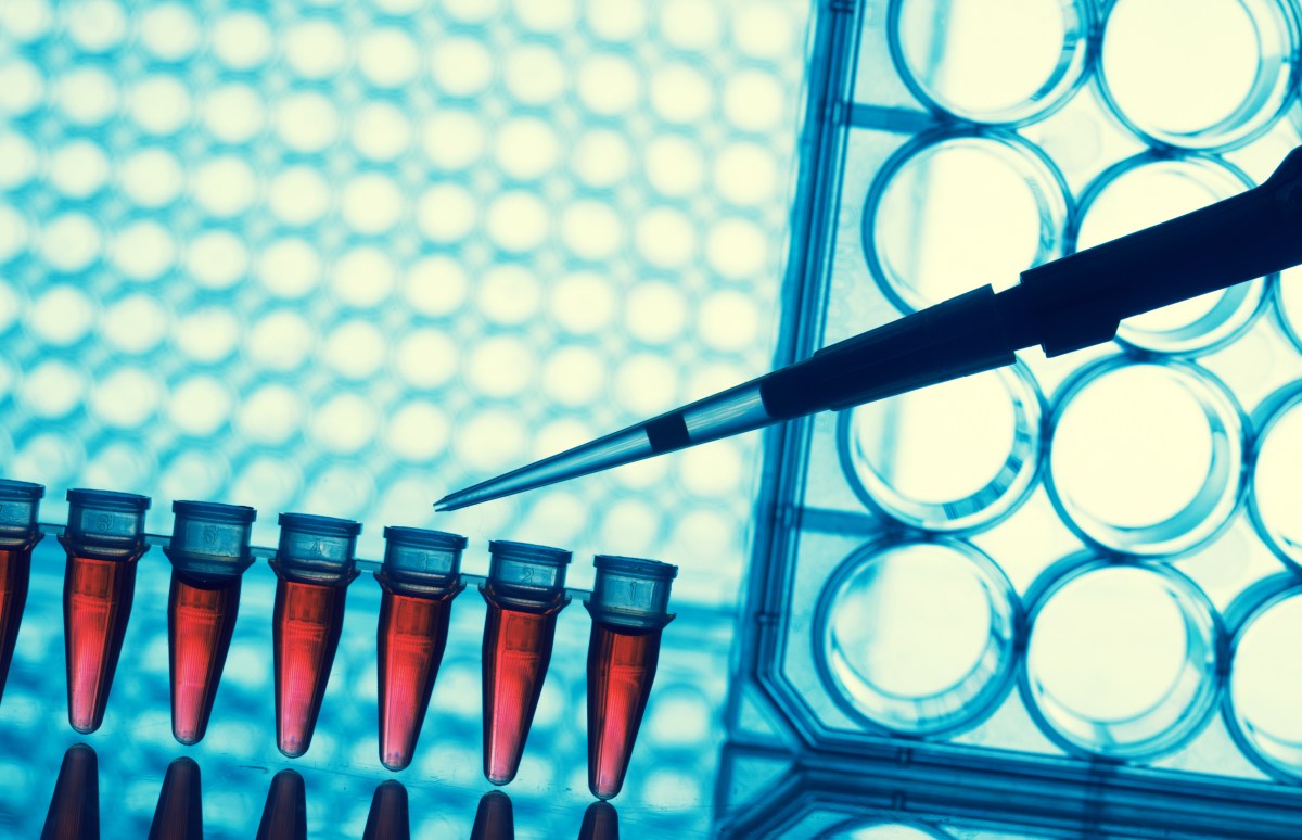 What is an Iron Panel test?