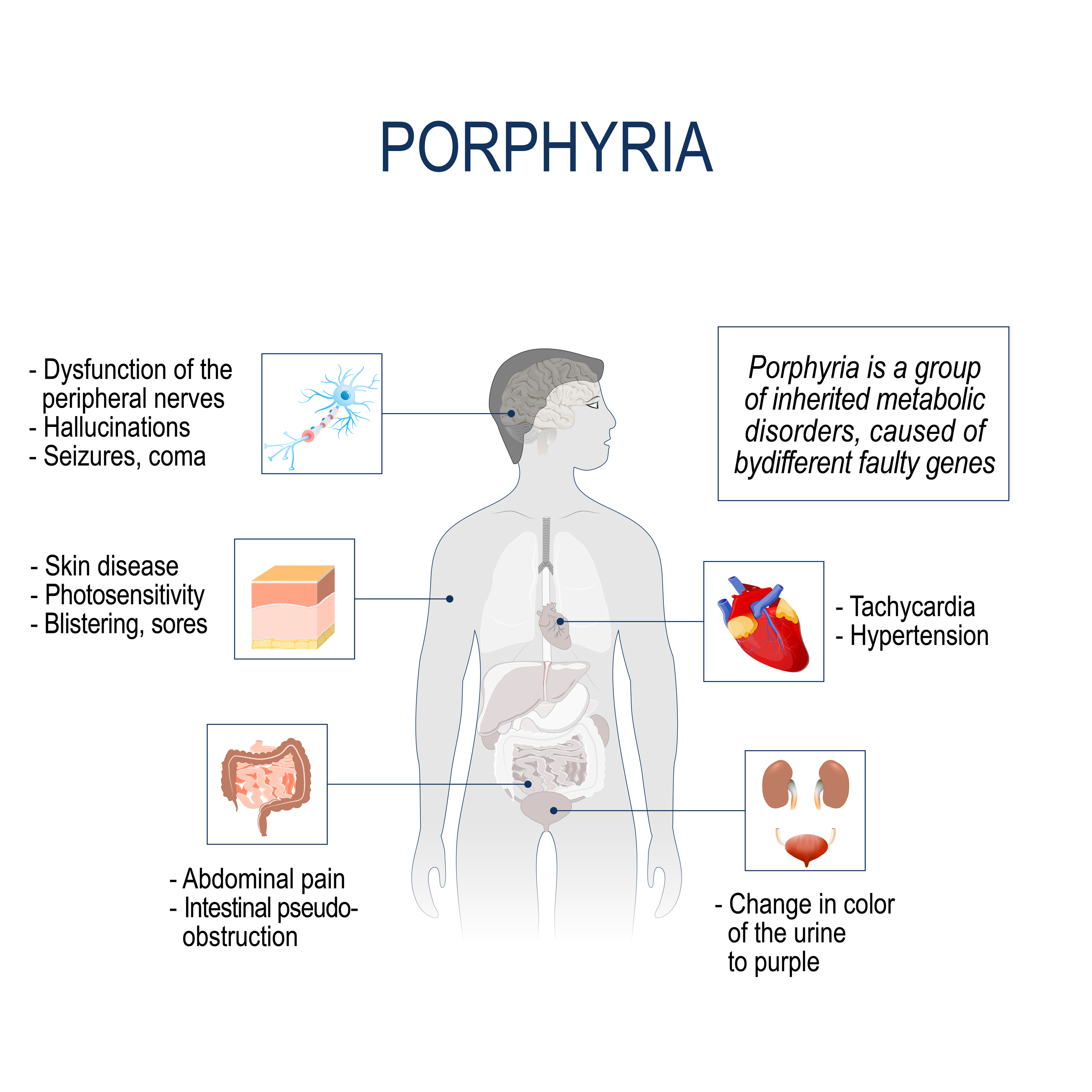What is Porphyria? Symptoms + Treatments