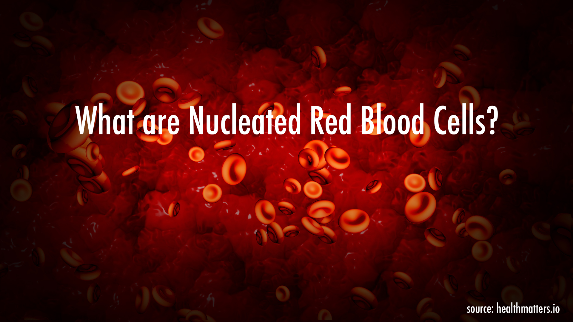 What are Nucleated red blood cell (NRBC)?