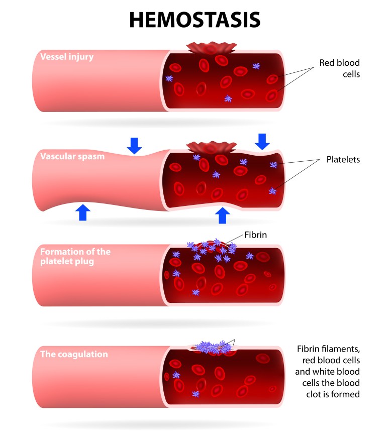 Activated partial thromboplastin time (APTT) test | Definitions+Normal ...
