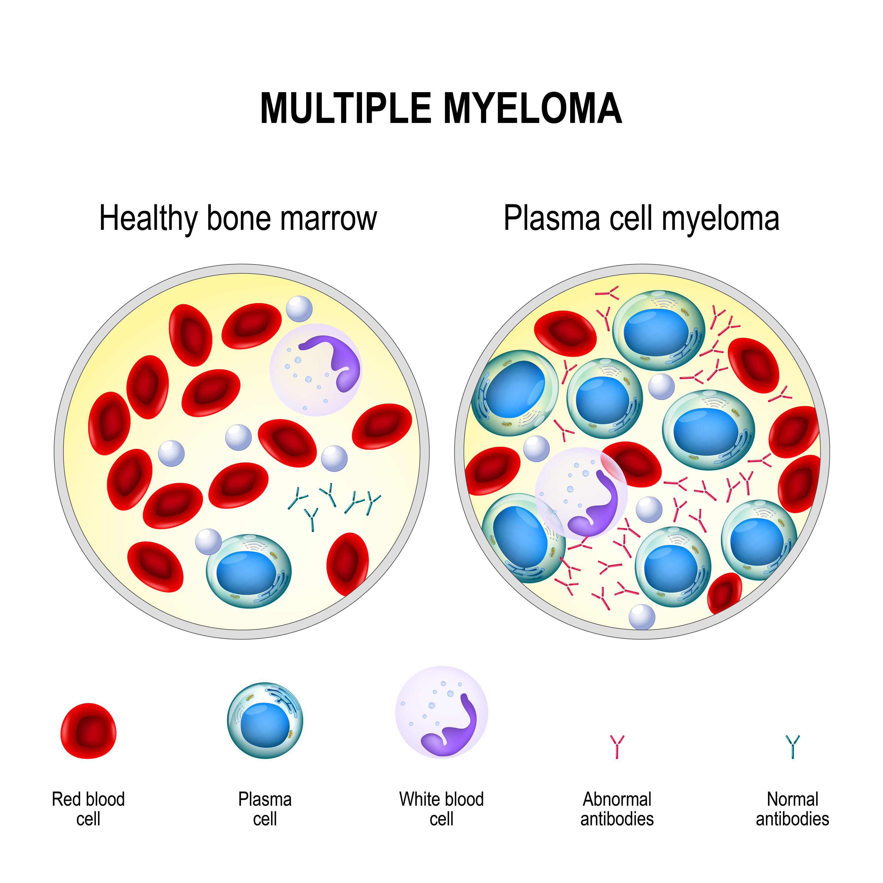 What is Beta-2 Microglobulin, (Serum), Definition + Reference Ranges