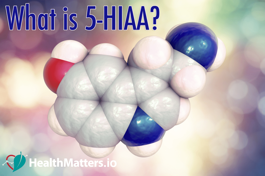What is 5-HIAA (Neurotransmitter)?