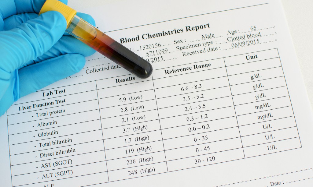 What is Alpha-2-Globulin (Serum)?
