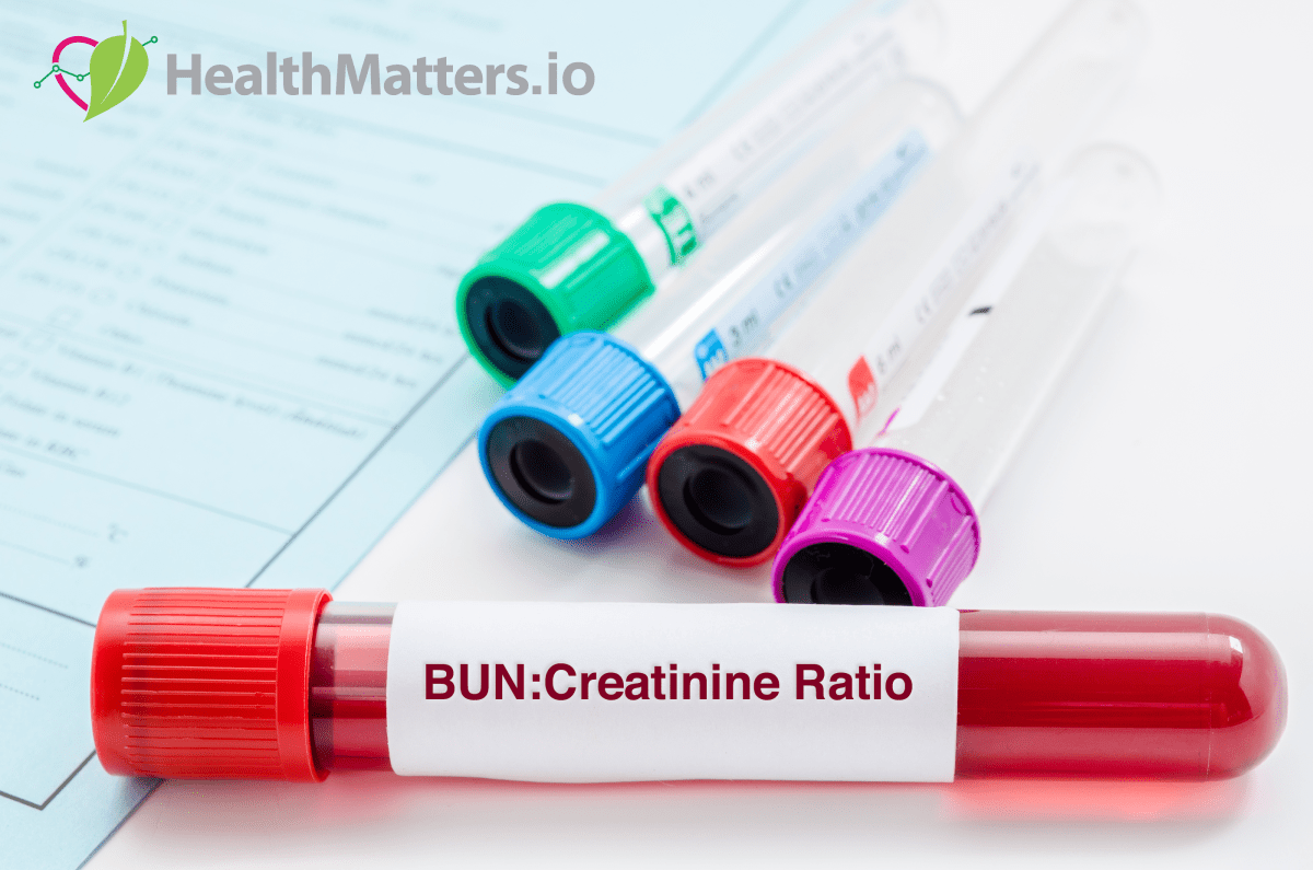 What is the BUN to Creatinine ratio?
