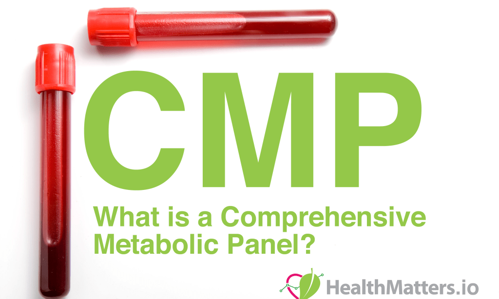 What is the CMP test?