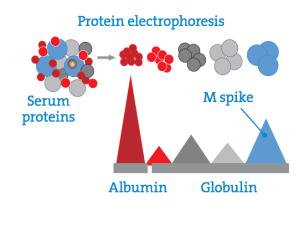 What is M-Spike (Urine)?