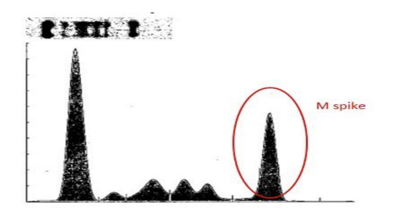 What is M-Spike (Urine)?