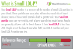 What is Small LDL-P? High and low values | Lab results explained