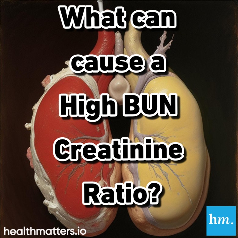 Understanding High BUN/Creatinine Ratio Causes